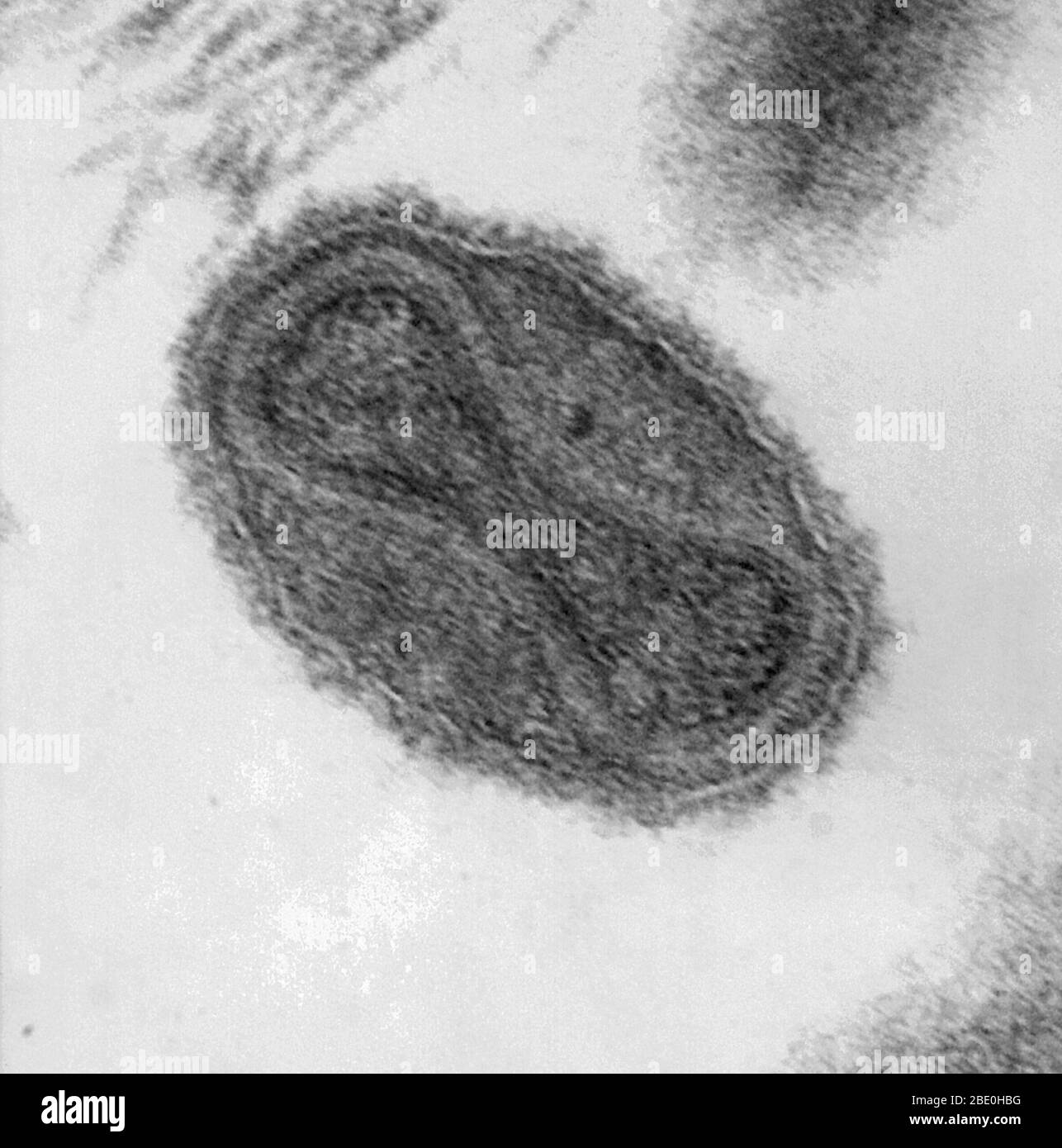 Viral High Resolution Stock Photography and Images - Alamy