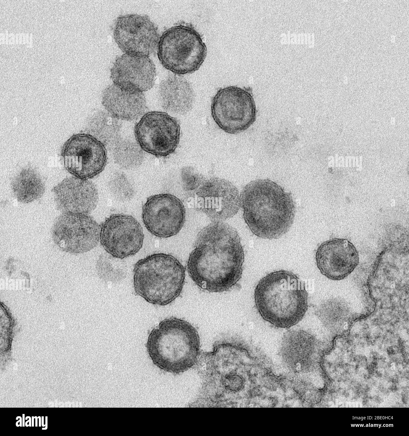 Transmission Electron Micrograph (TEM) showing budding, immature and ...