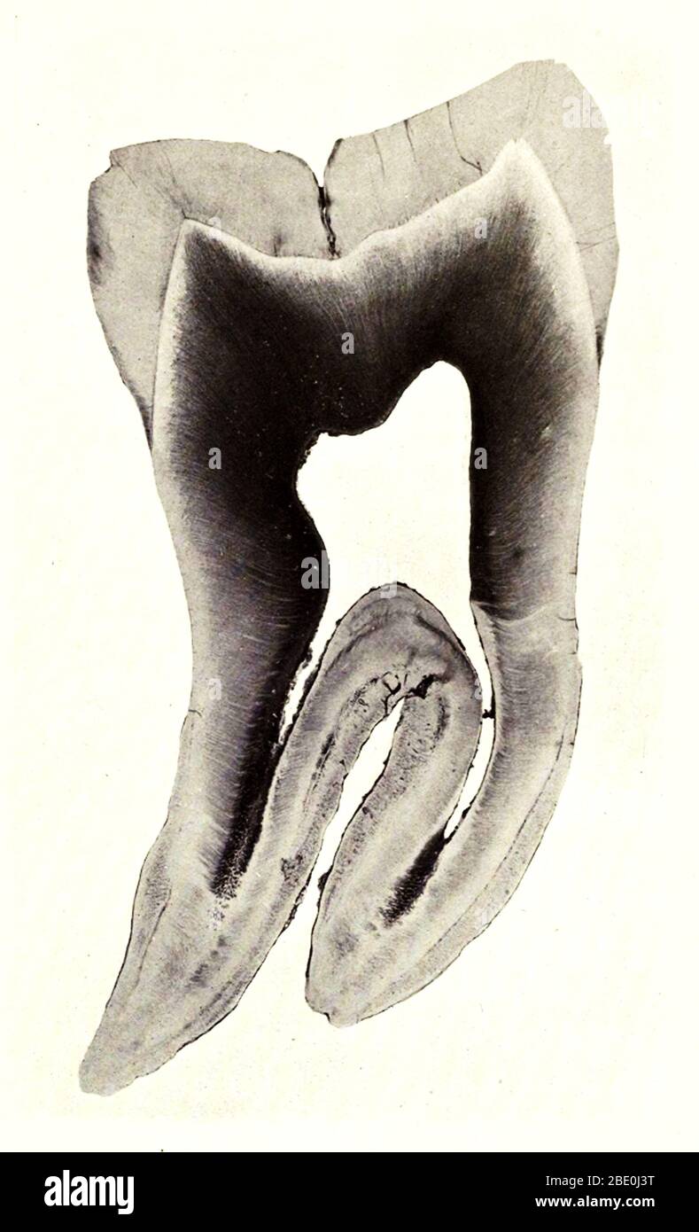 Photomicrograph human hi-res stock photography and images - Alamy