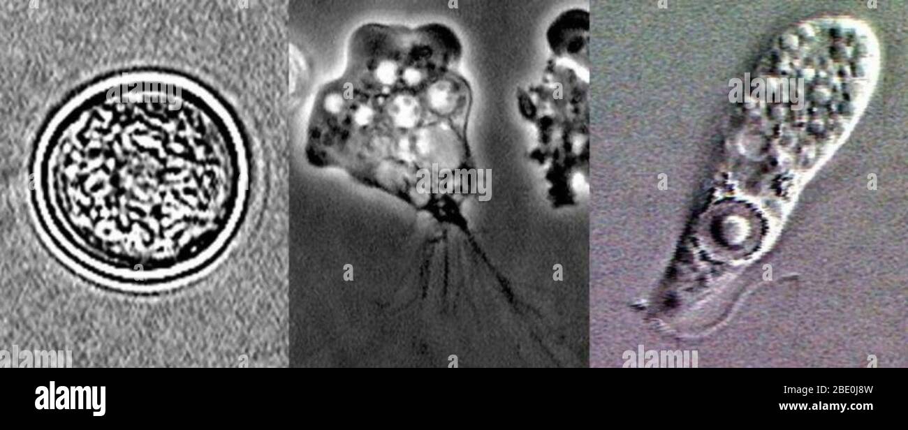 Brain-eating amoeba: Primary amoebic meningoencephalitis. Naegleria ...