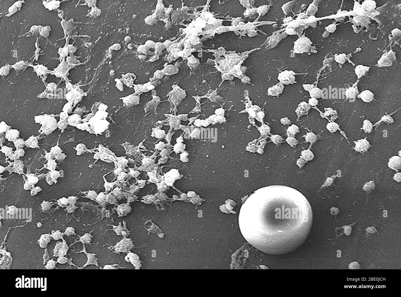Bacteria cell electron micrograph hi-res stock photography and images ...