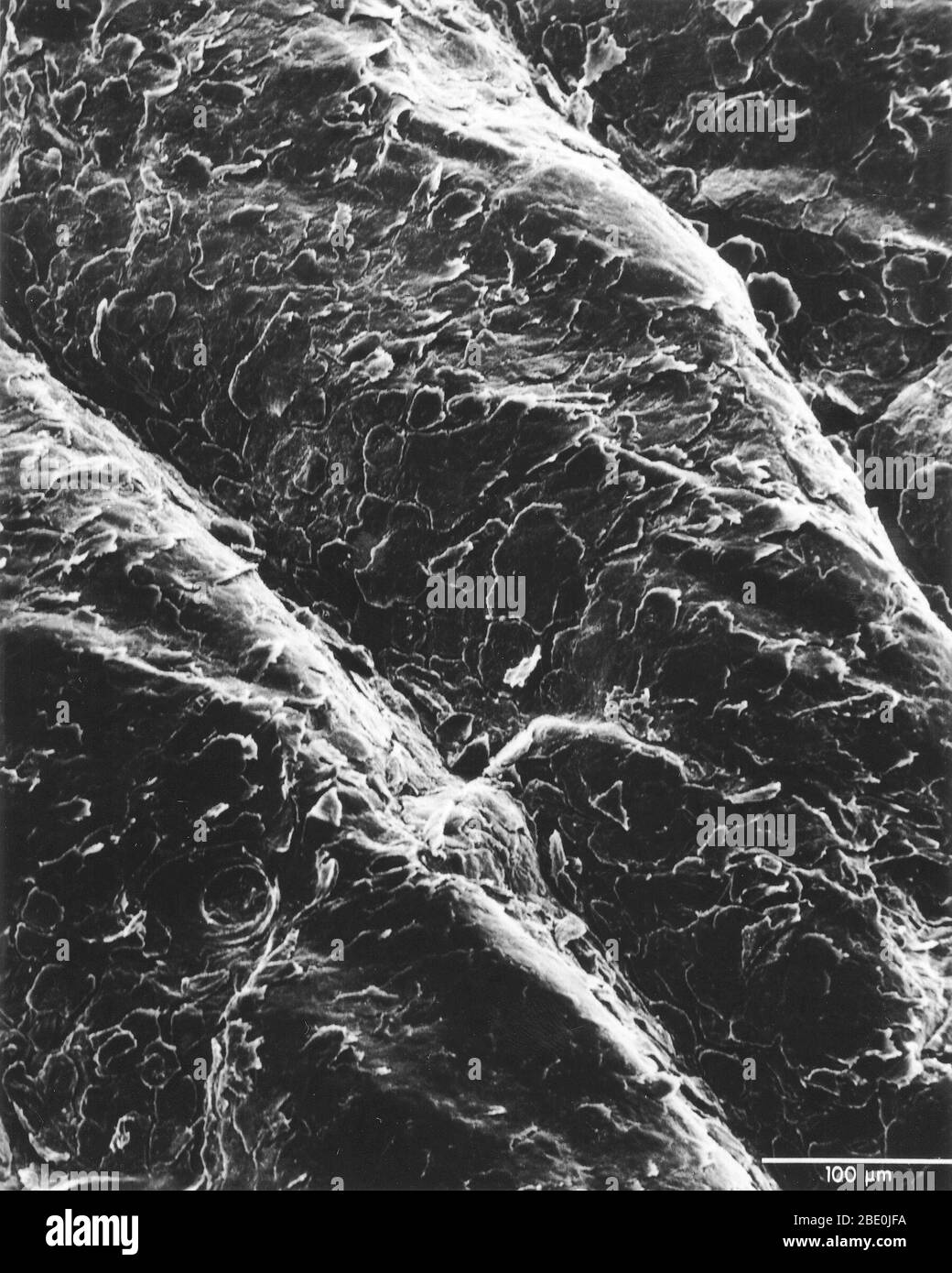 Skin surface, sem hi-res stock photography and images - Alamy Skin surface, sem hi-res stock photography and images - Alamy