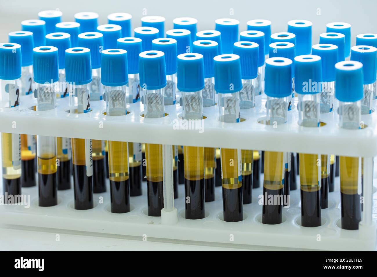 Lab blood test tubes in holder on table in laboratory. Medical ...