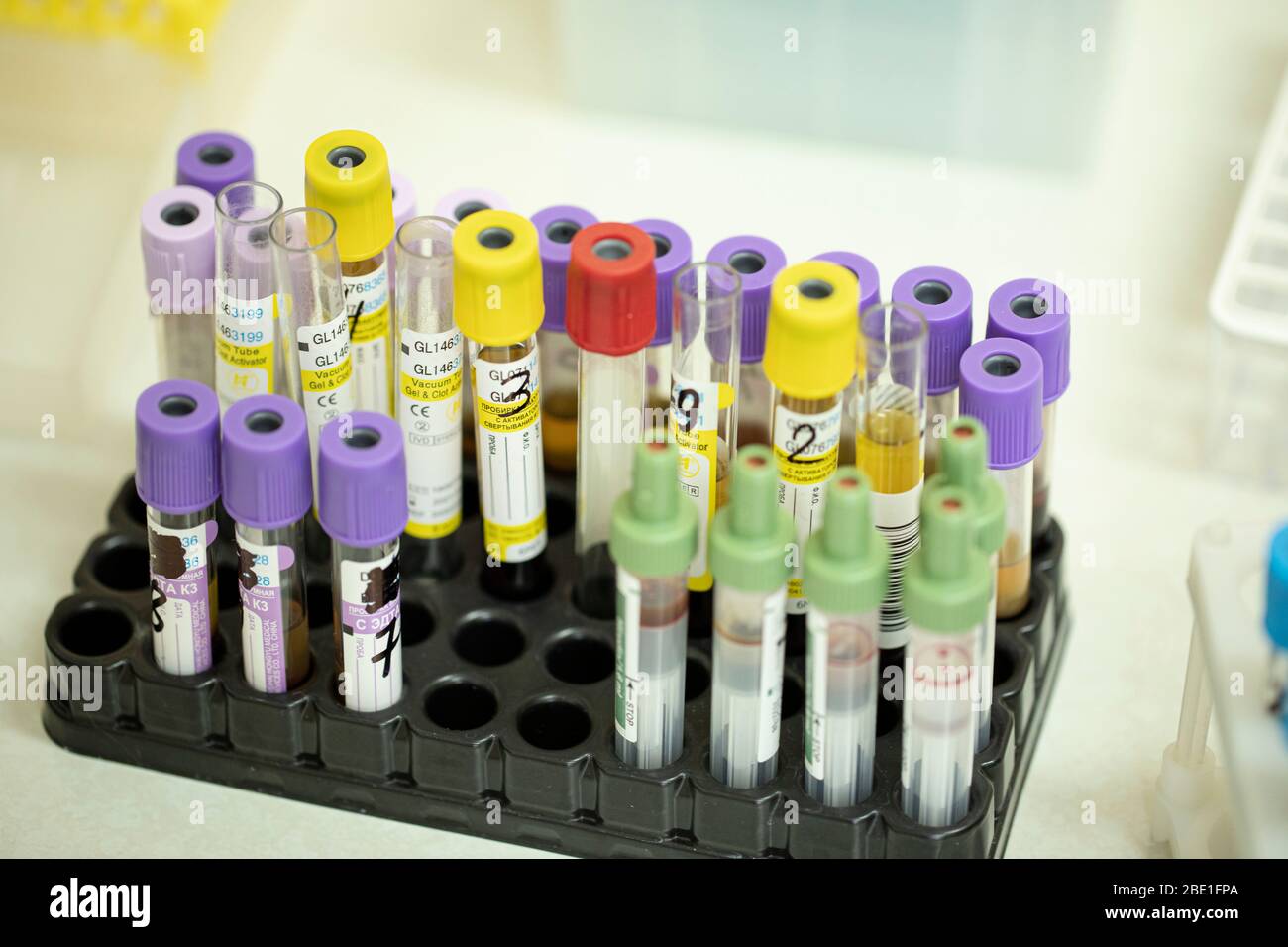 Blood samples in rack. Lab diagnostics biochemical analysis, hiv, aids ...