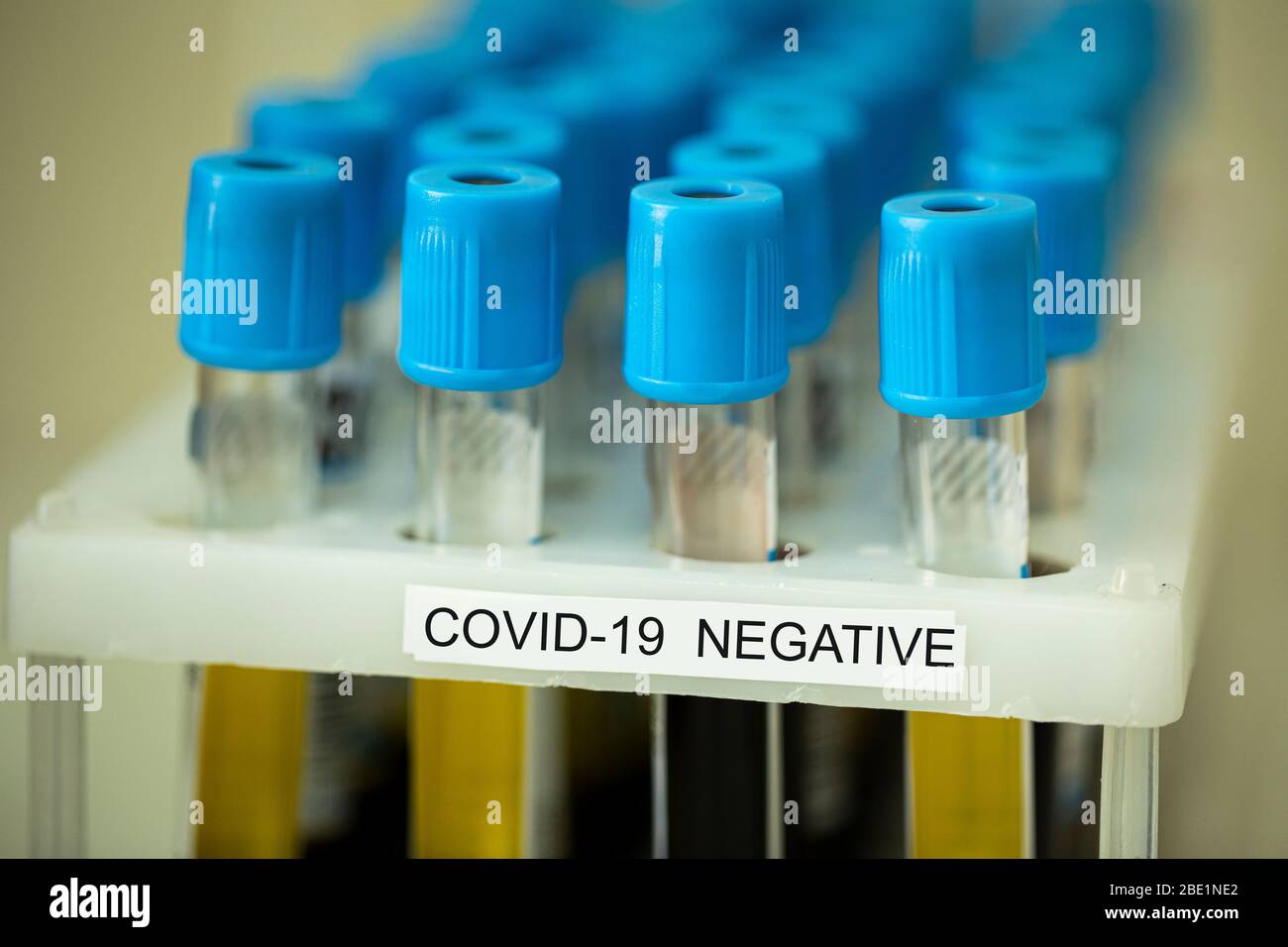 Close up Negative COVID-19 coronavirus test laboratory sample of blood ...