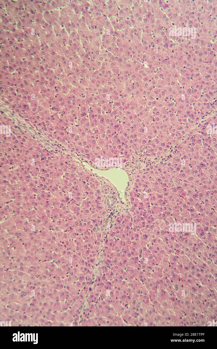 Pork liver tissue cut 100x Stock Photo - Alamy