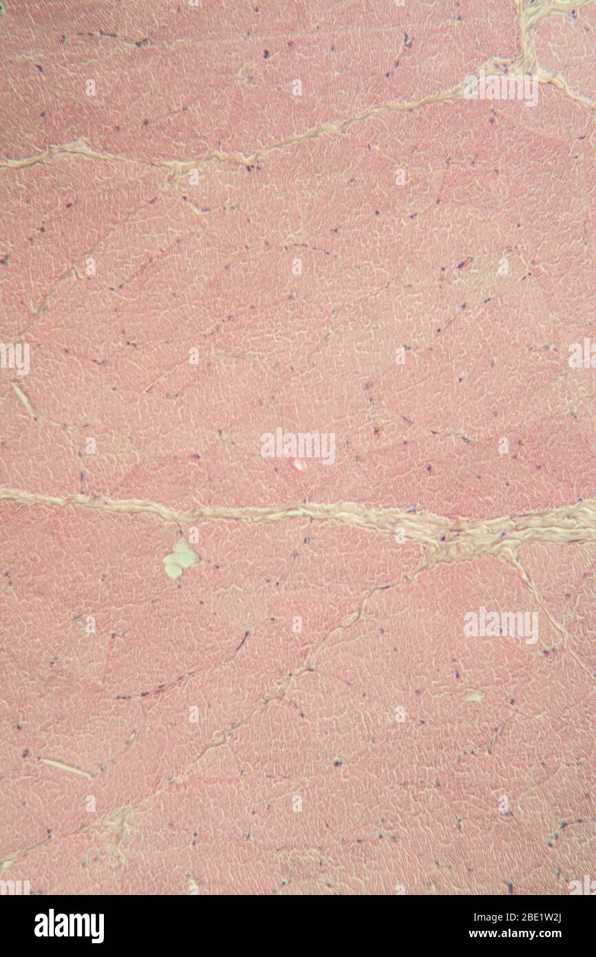 Skin histology hi-res stock photography and images - Alamy