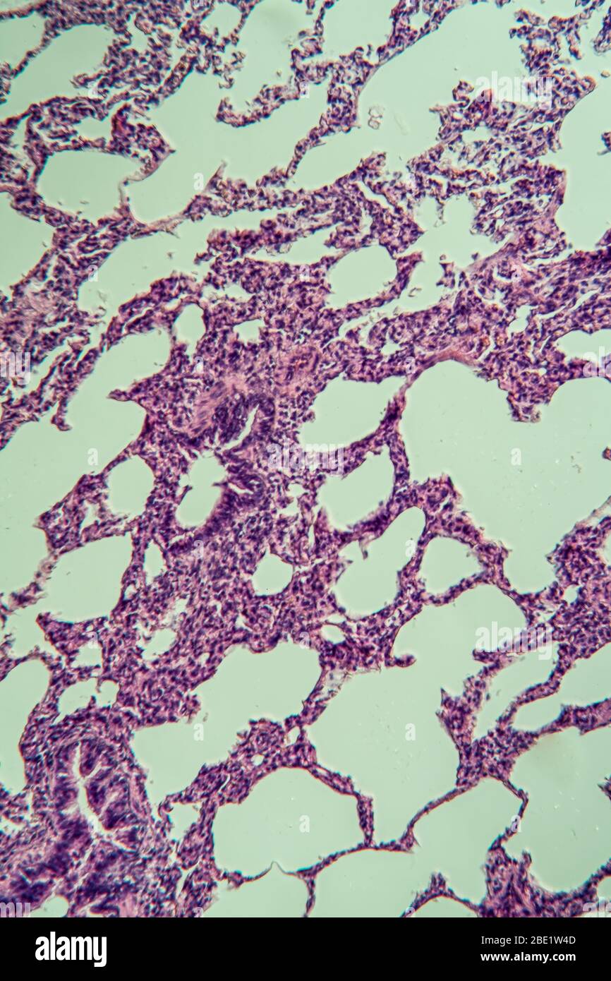 Lung Microscope Slide