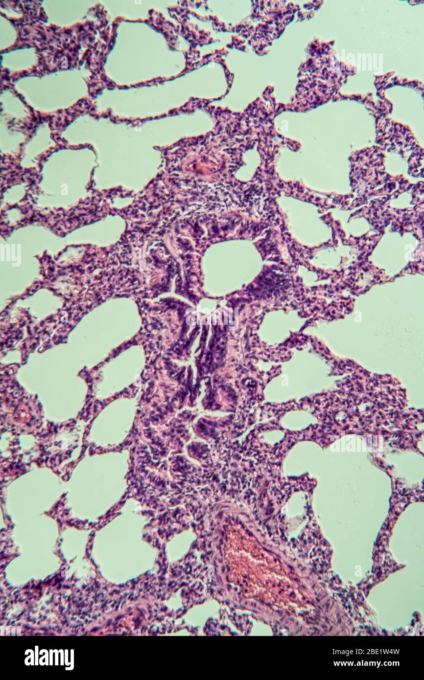 Lungs under the microscope 100x Stock Photo - Alamy