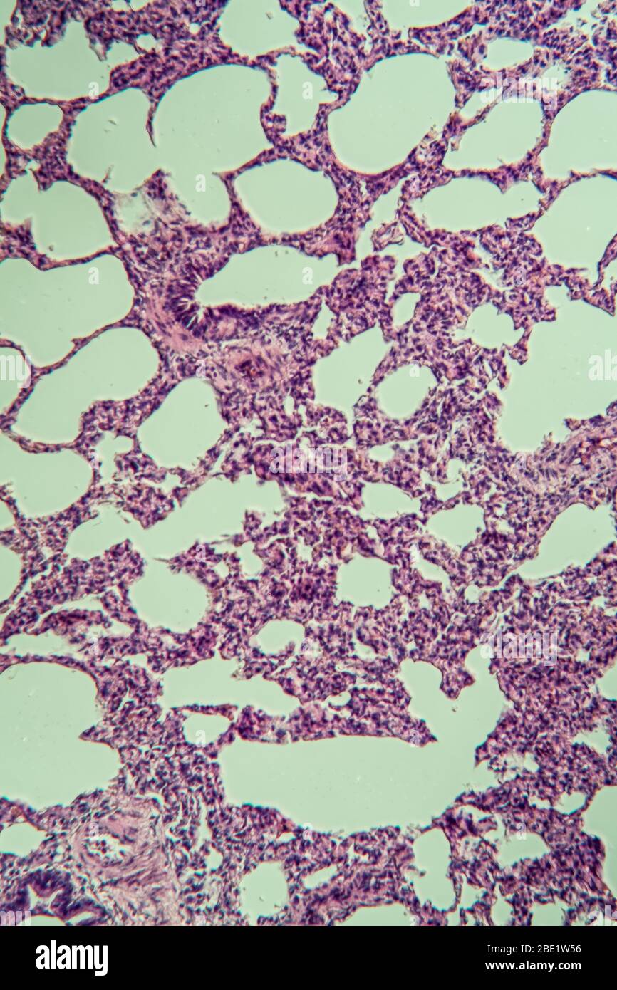 Lungs under the microscope 100x Stock Photo - Alamy