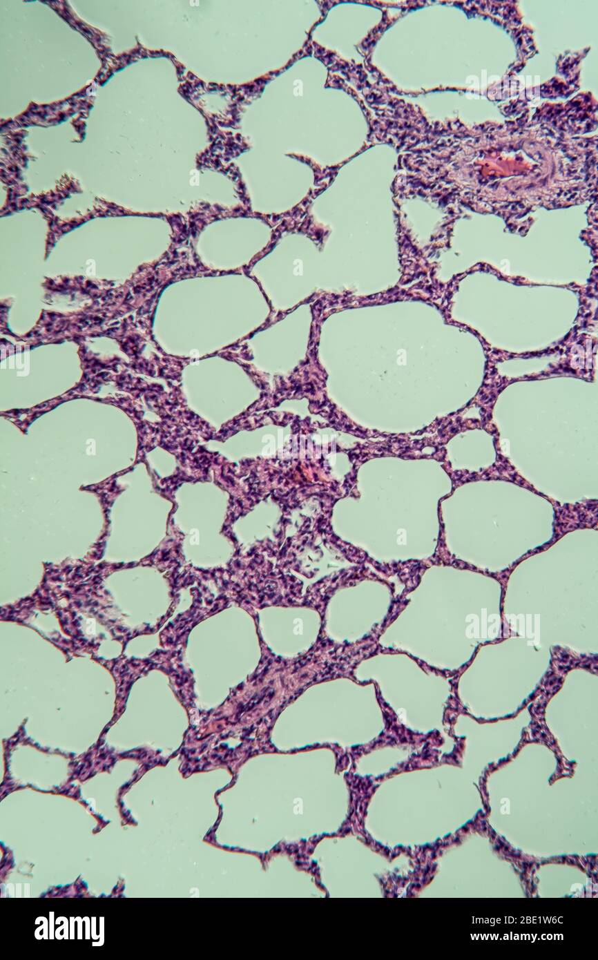 Lungs under the microscope 100x Stock Photo - Alamy