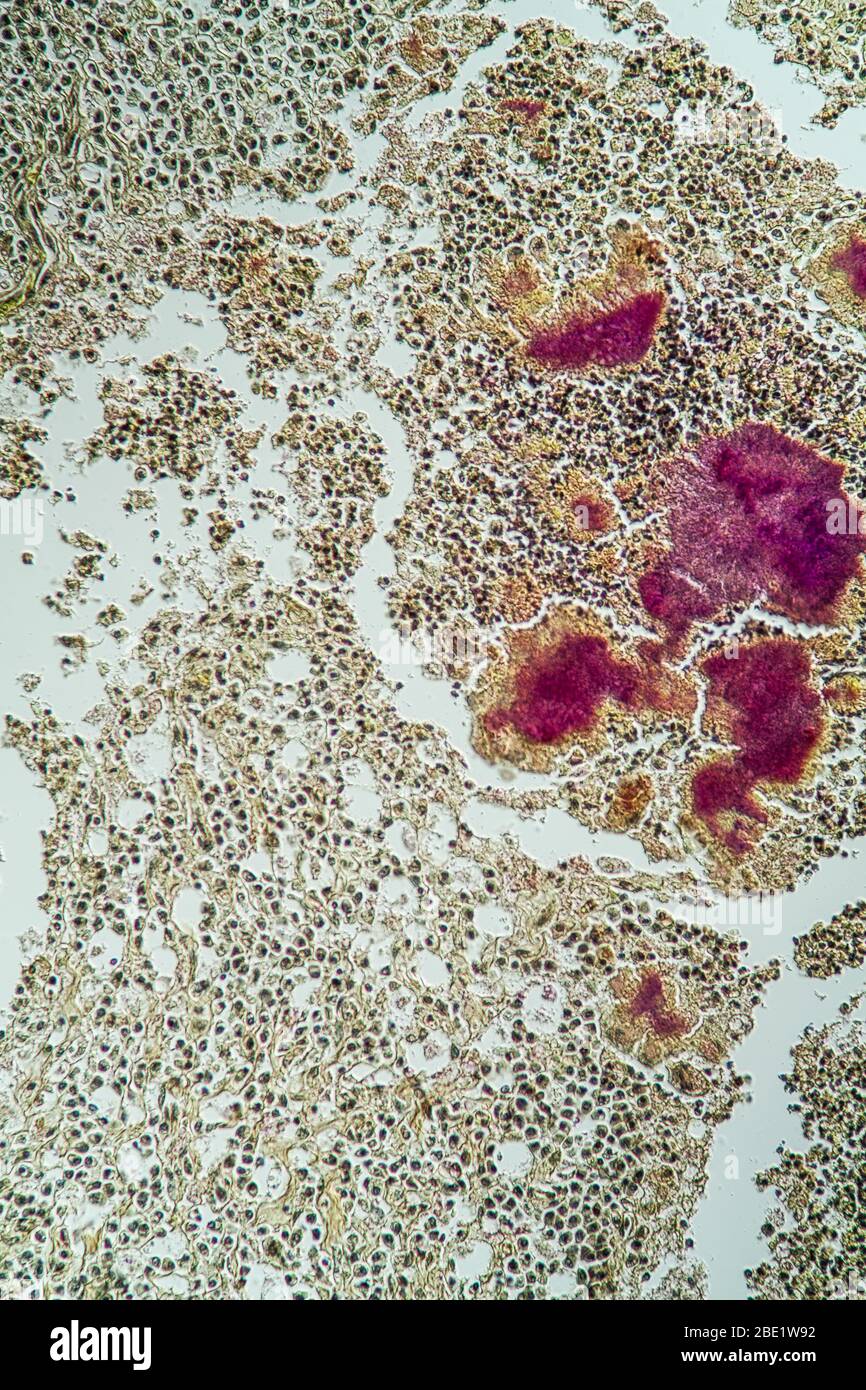 Actinomyces hi-res stock photography and images - Alamy