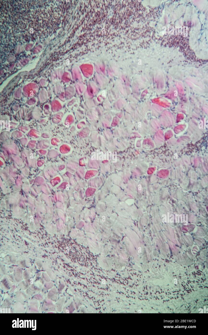 Sarcocystis High Resolution Stock Photography and Images - Alamy