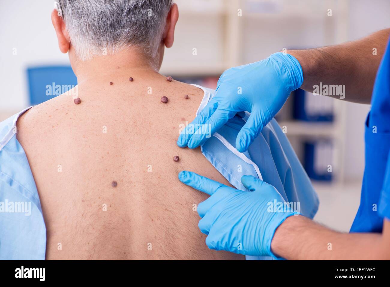 Old man pimple removal hi-res stock photography and images - Alamy