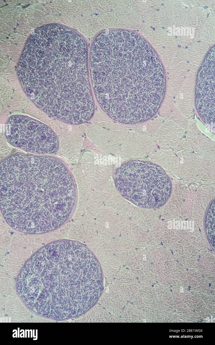 Sarcocystis hi-res stock photography and images - Alamy