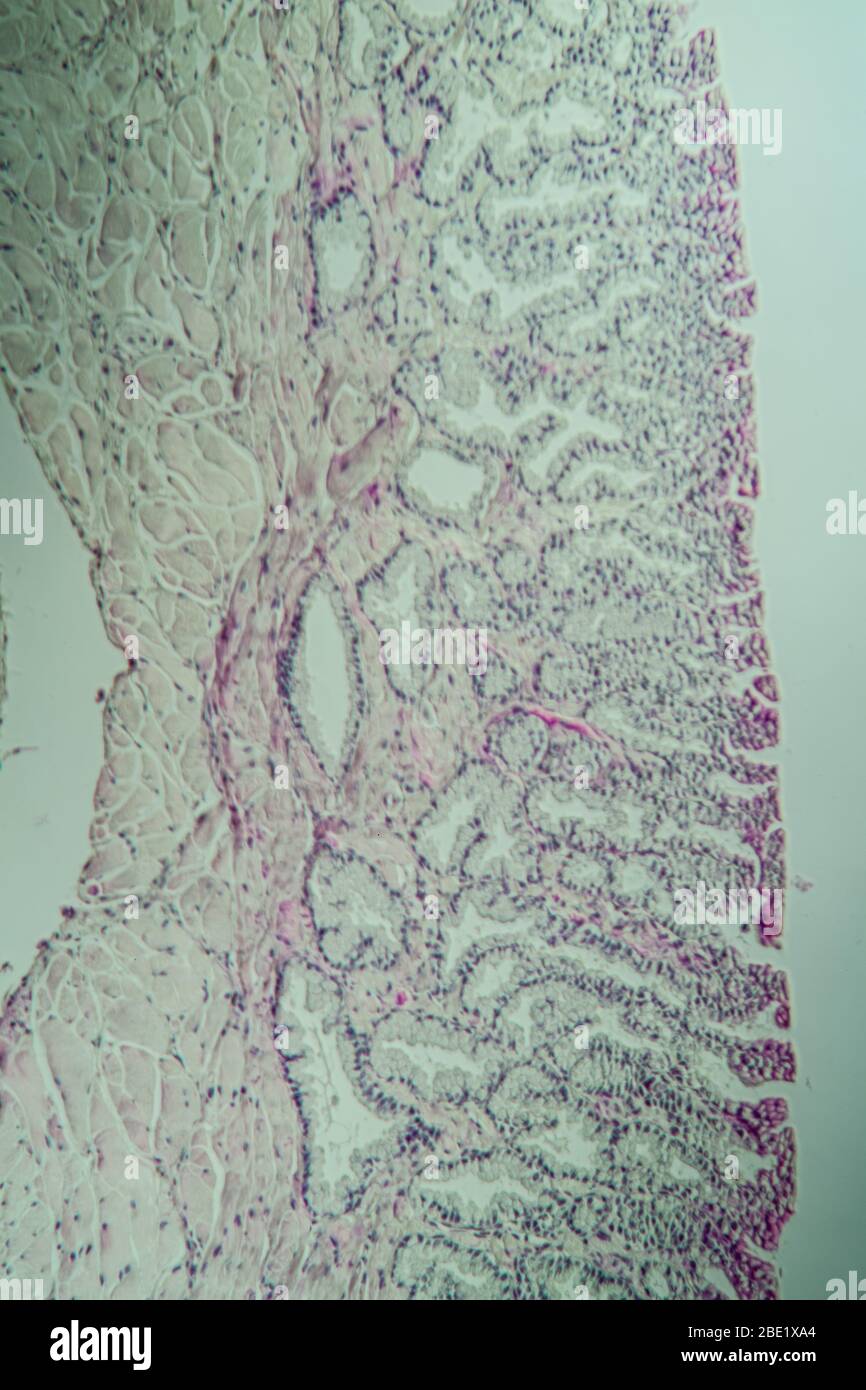 Papillae cross section hi-res stock photography and images - Alamy