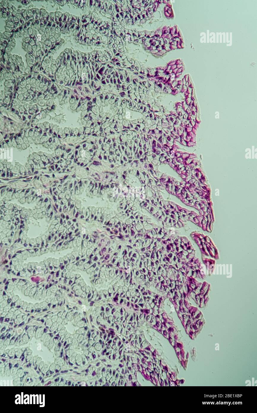 Papillae cross section hi-res stock photography and images - Alamy