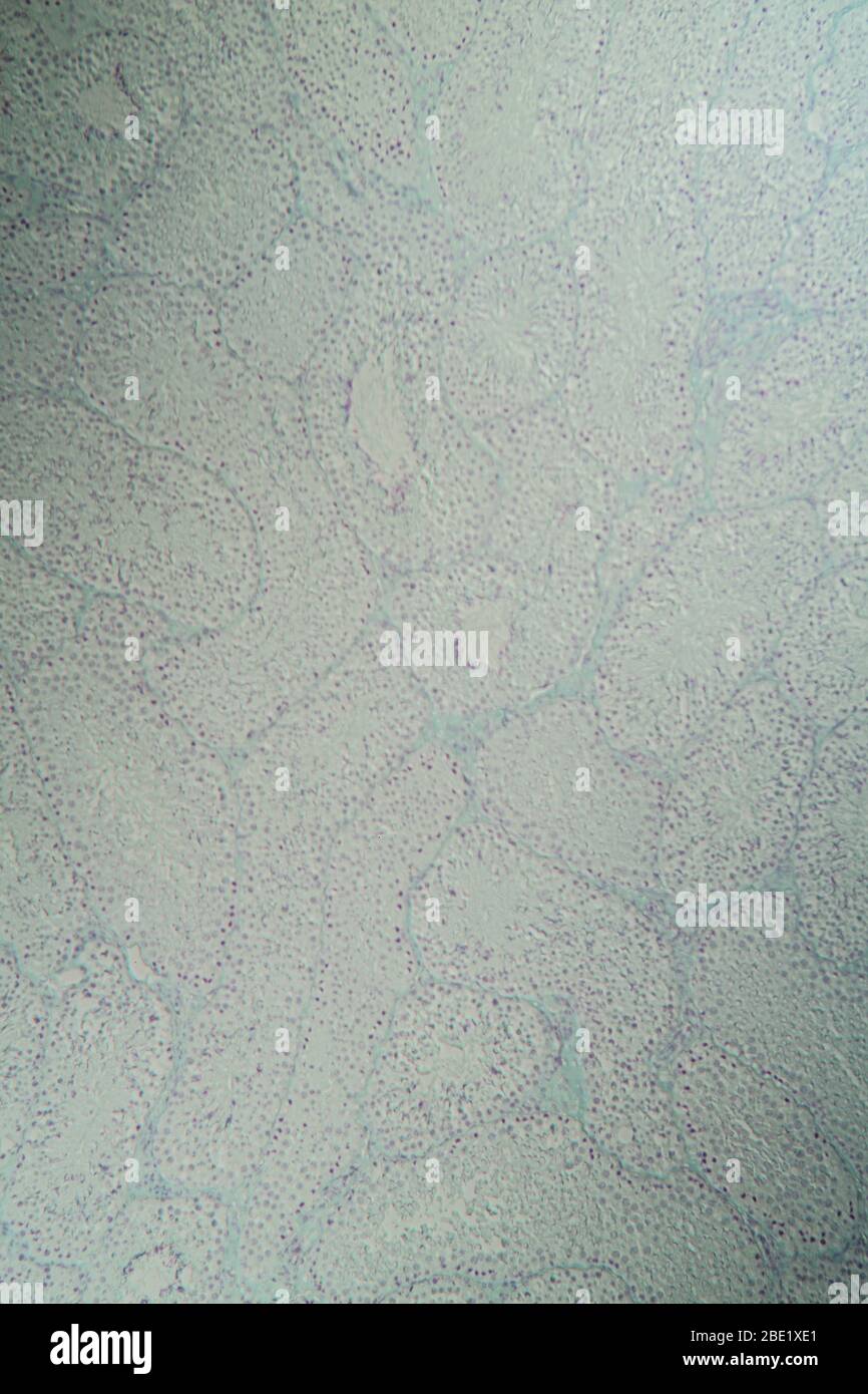 Testicle cross-section under the microscope 100x Stock Photo - Alamy