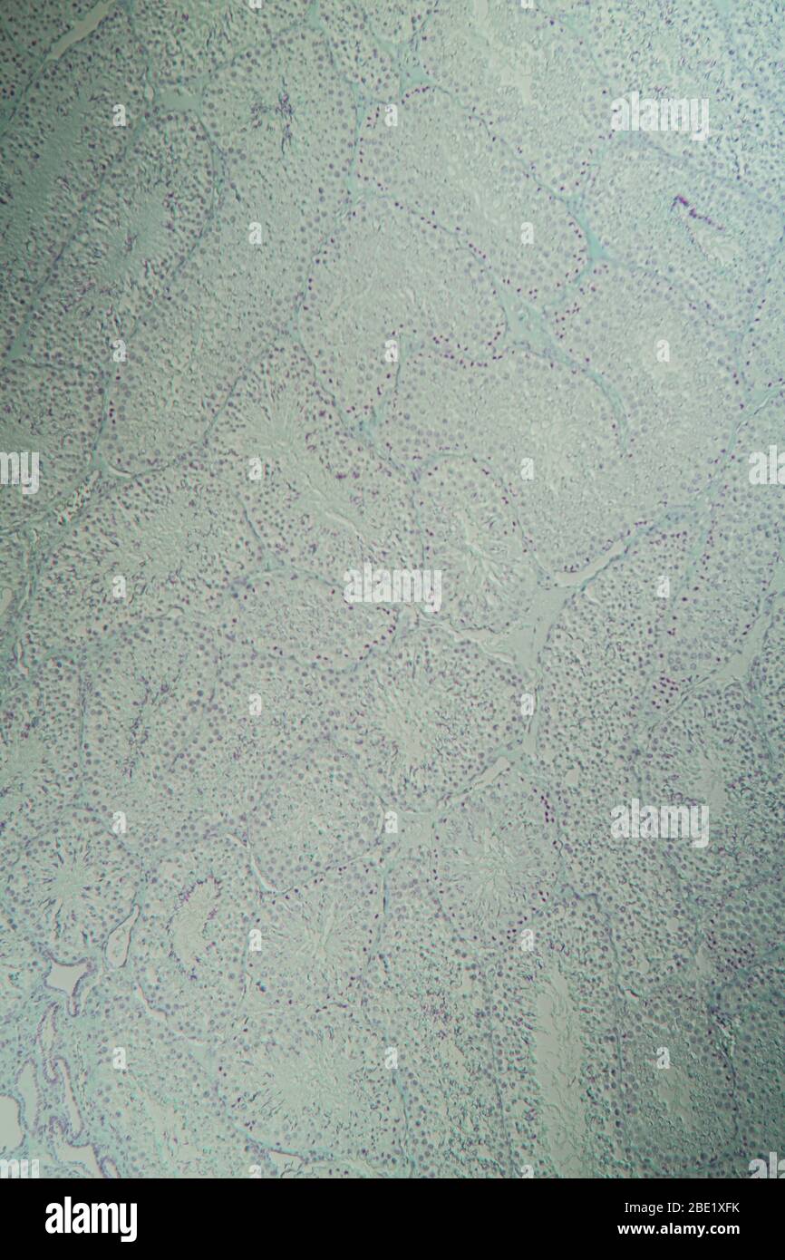 Testicle cross-section under the microscope 100x Stock Photo - Alamy