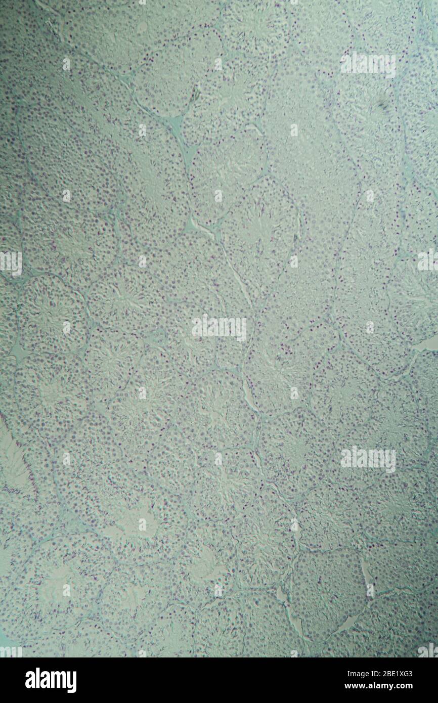 Testicle cross-section under the microscope 100x Stock Photo - Alamy