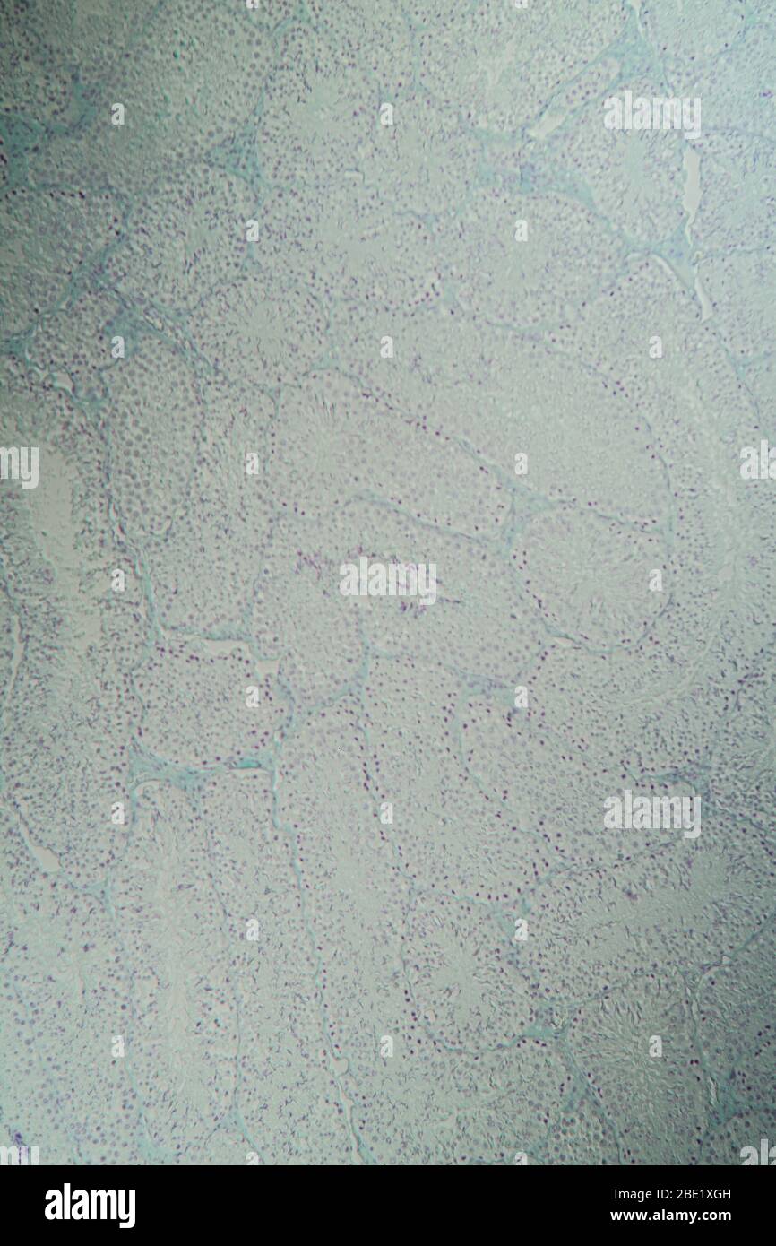 Testicle cross-section under the microscope 100x Stock Photo - Alamy