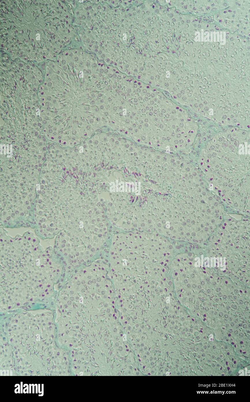 Testicle cross-section under the microscope 100x Stock Photo - Alamy