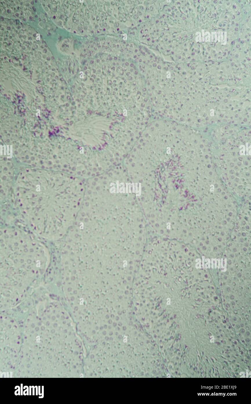 Testicle cross-section under the microscope 100x Stock Photo - Alamy