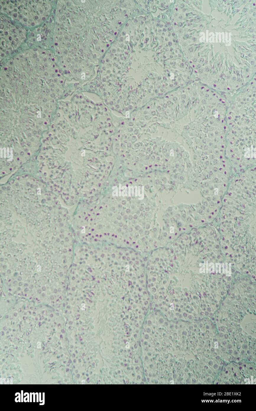 Testicle cross-section under the microscope 100x Stock Photo - Alamy