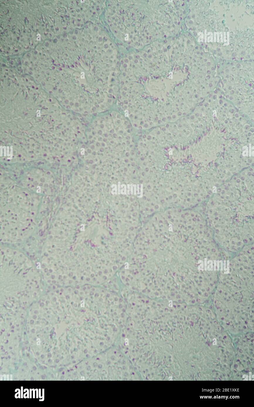 Testicle cross-section under the microscope 100x Stock Photo - Alamy
