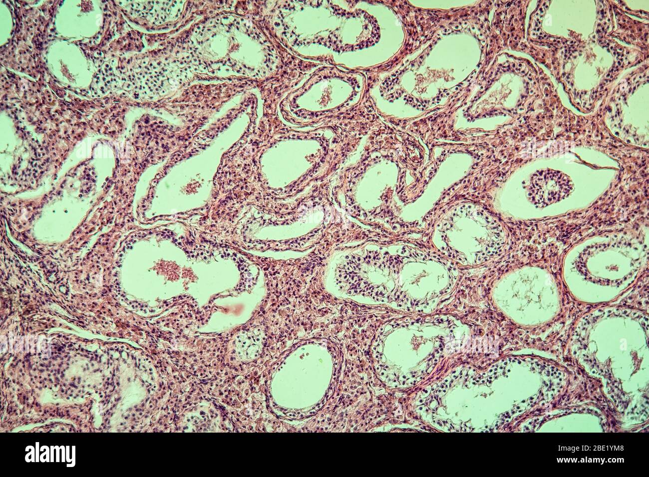 Inguinal testicles gonadically diseased tissue 100x Stock Photo - Alamy