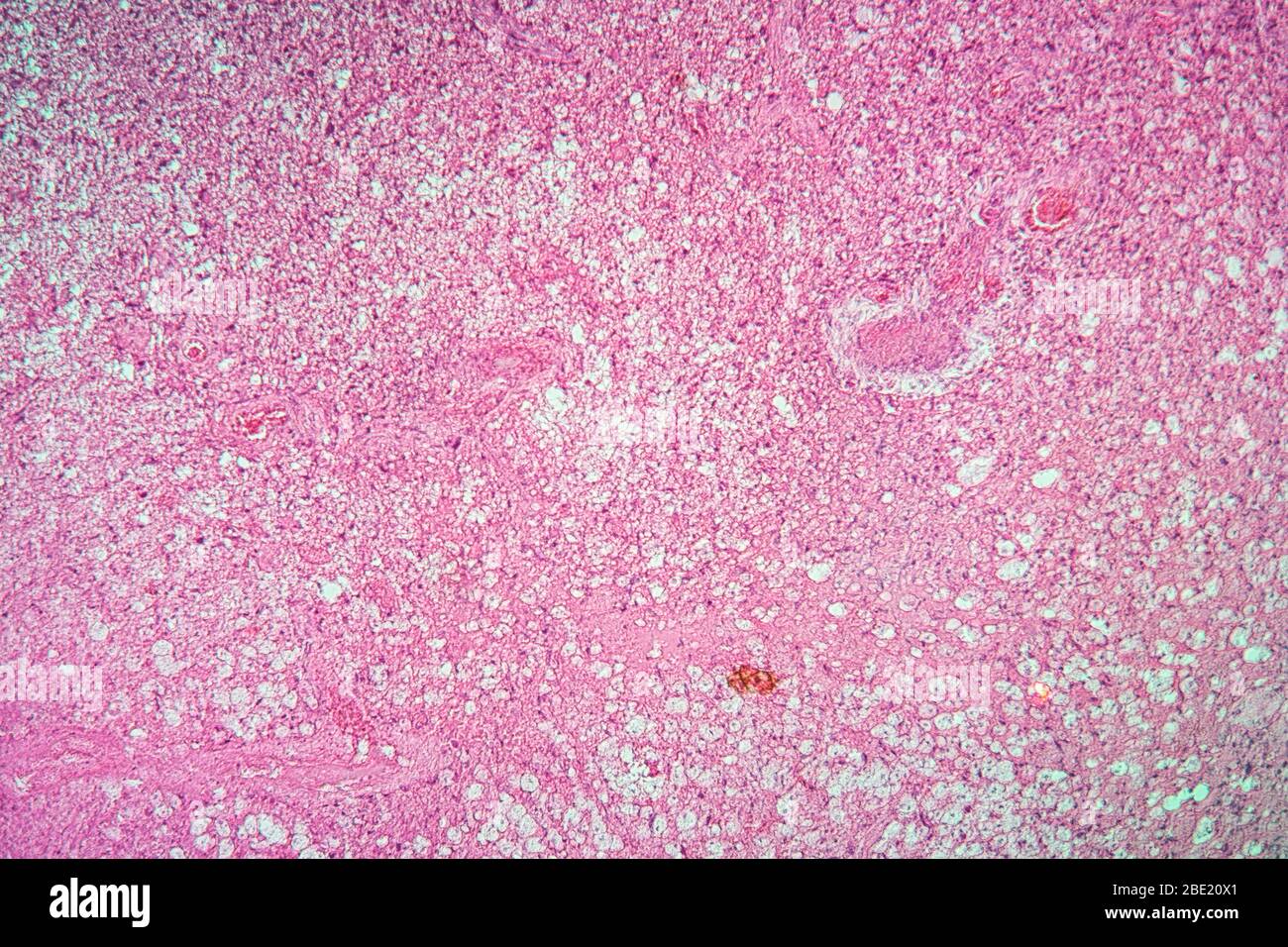 Brain rot hi-res stock photography and images - Alamy