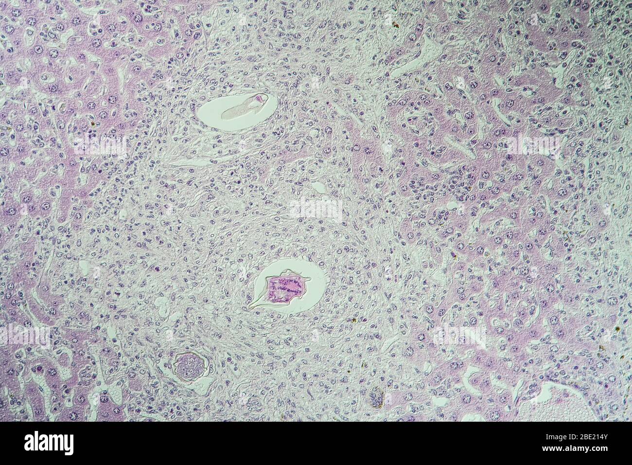 Tissue with schistosomiasis sick tissue 100x Stock Photo - Alamy