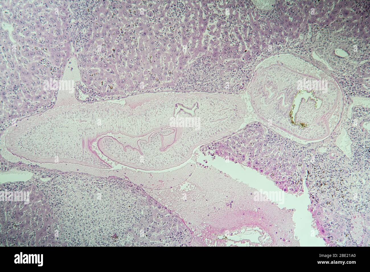 Schistosomiasis High Resolution Stock Photography and Images - Alamy