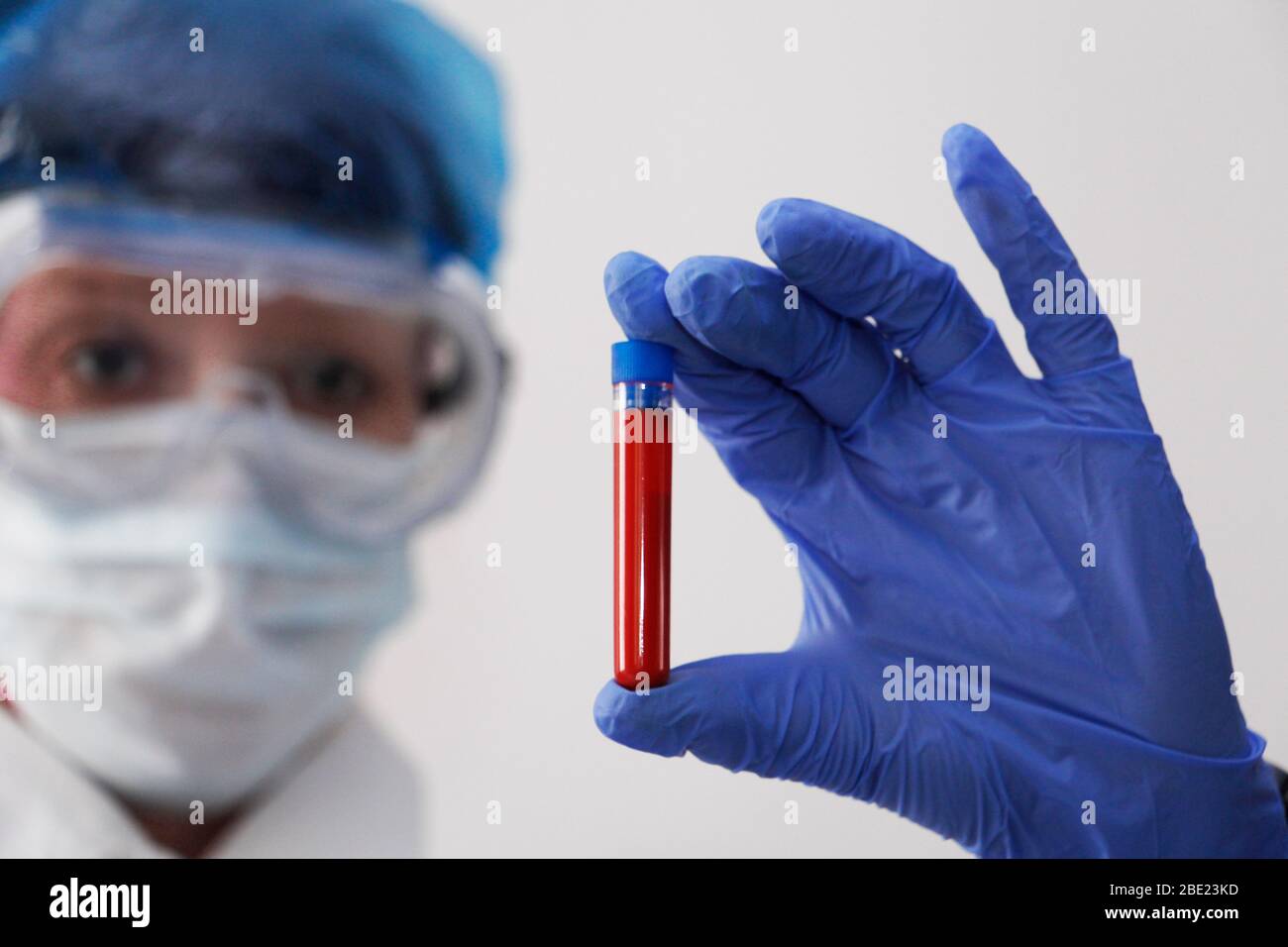 A nurse holds a test tube with blood in her hand. Laboratory test for ...