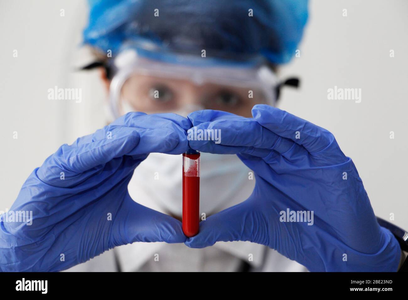 A nurse holds a test tube with blood in her hand. Laboratory test for ...