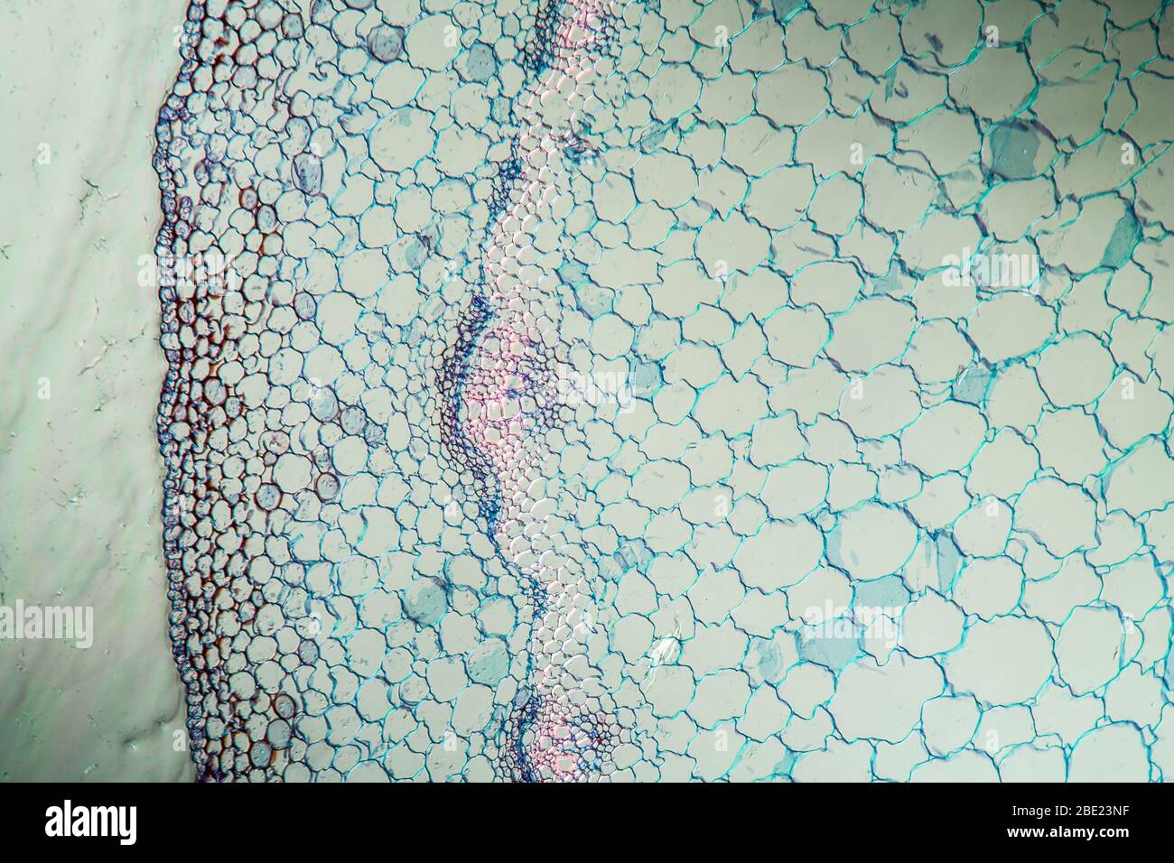 Nettle cells hi-res stock photography and images - Alamy
