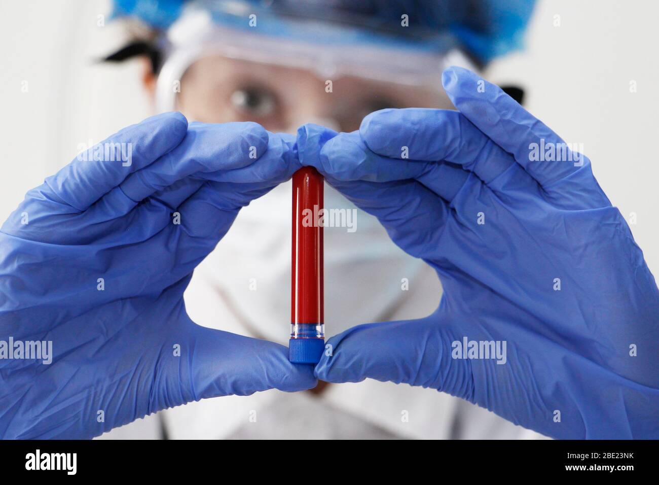A nurse holds a test tube with blood in her hand. Laboratory test for ...