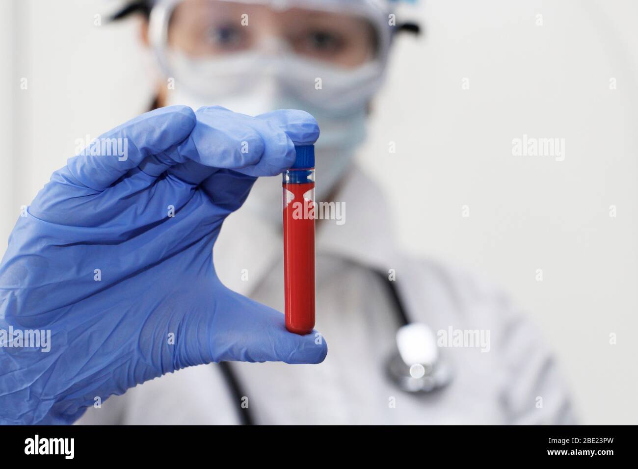 A nurse holds a test tube with blood in her hand. Laboratory test for ...