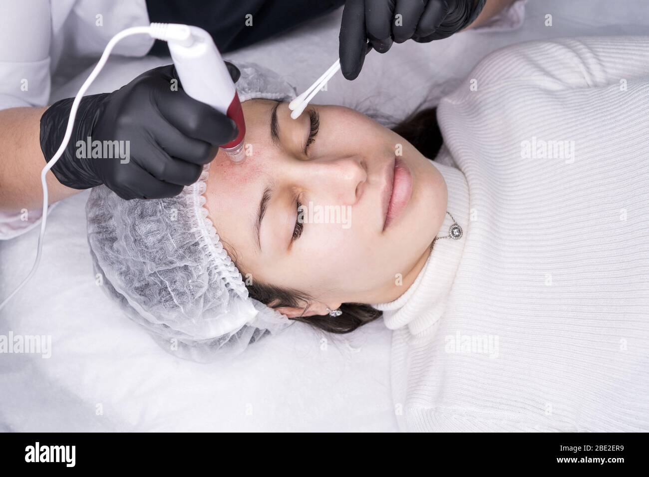 Cosmetologist making mesotherapy injection. Microneedle mesotherapy ...