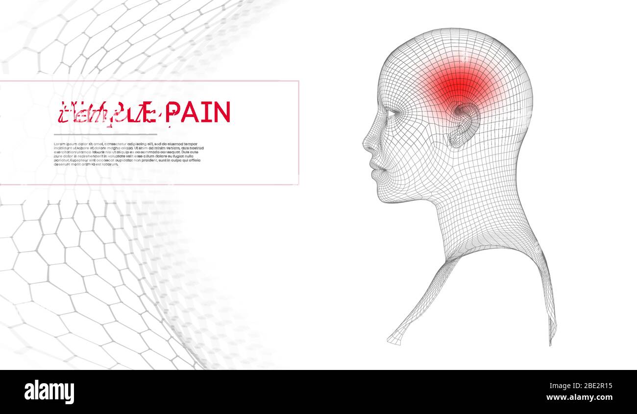 Beautiful woman suffering from headache in temples. Medical vector ...