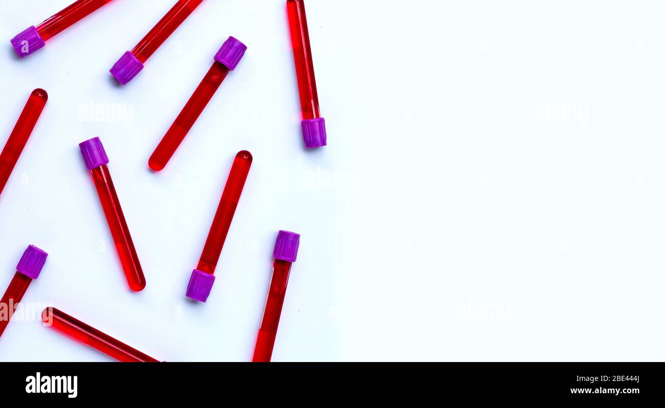 Blood in test tubes on white white background. Copy space Stock Photo ...