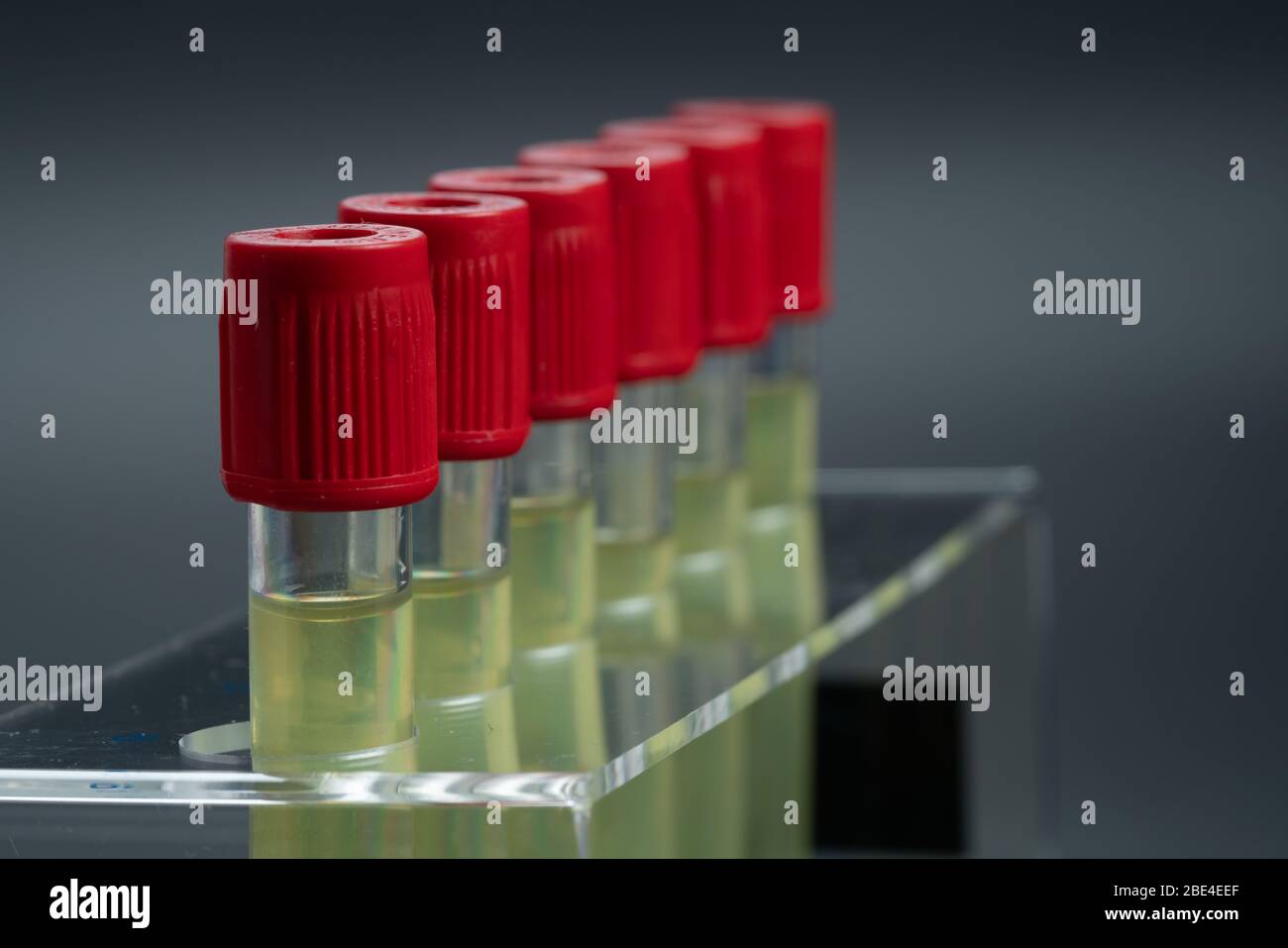 Test tubes with chemical samples in science laboratory Stock Photo - Alamy