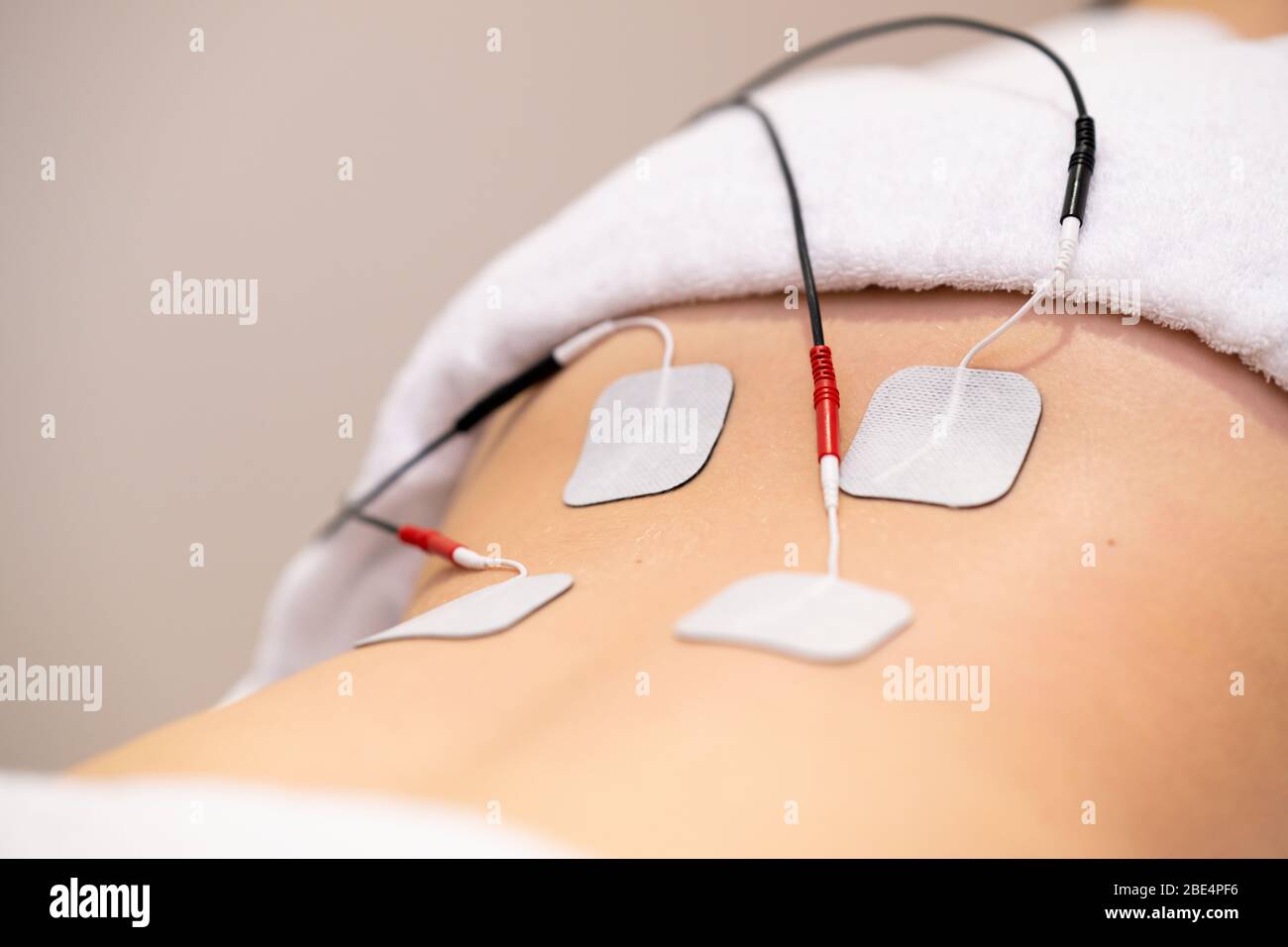Electro stimulation in physical therapy to a young woman Stock Photo ...