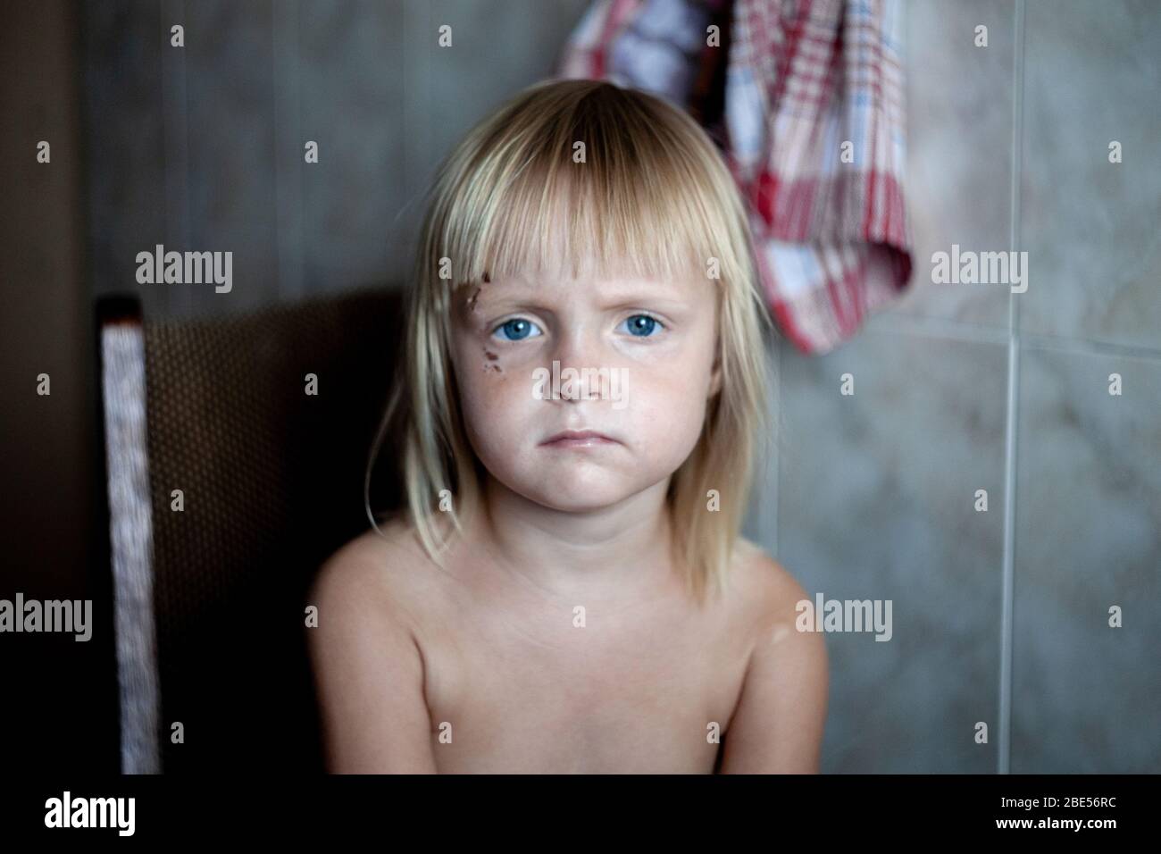 Portrait of a battered child girl. Concept of domestic violence Stock ...