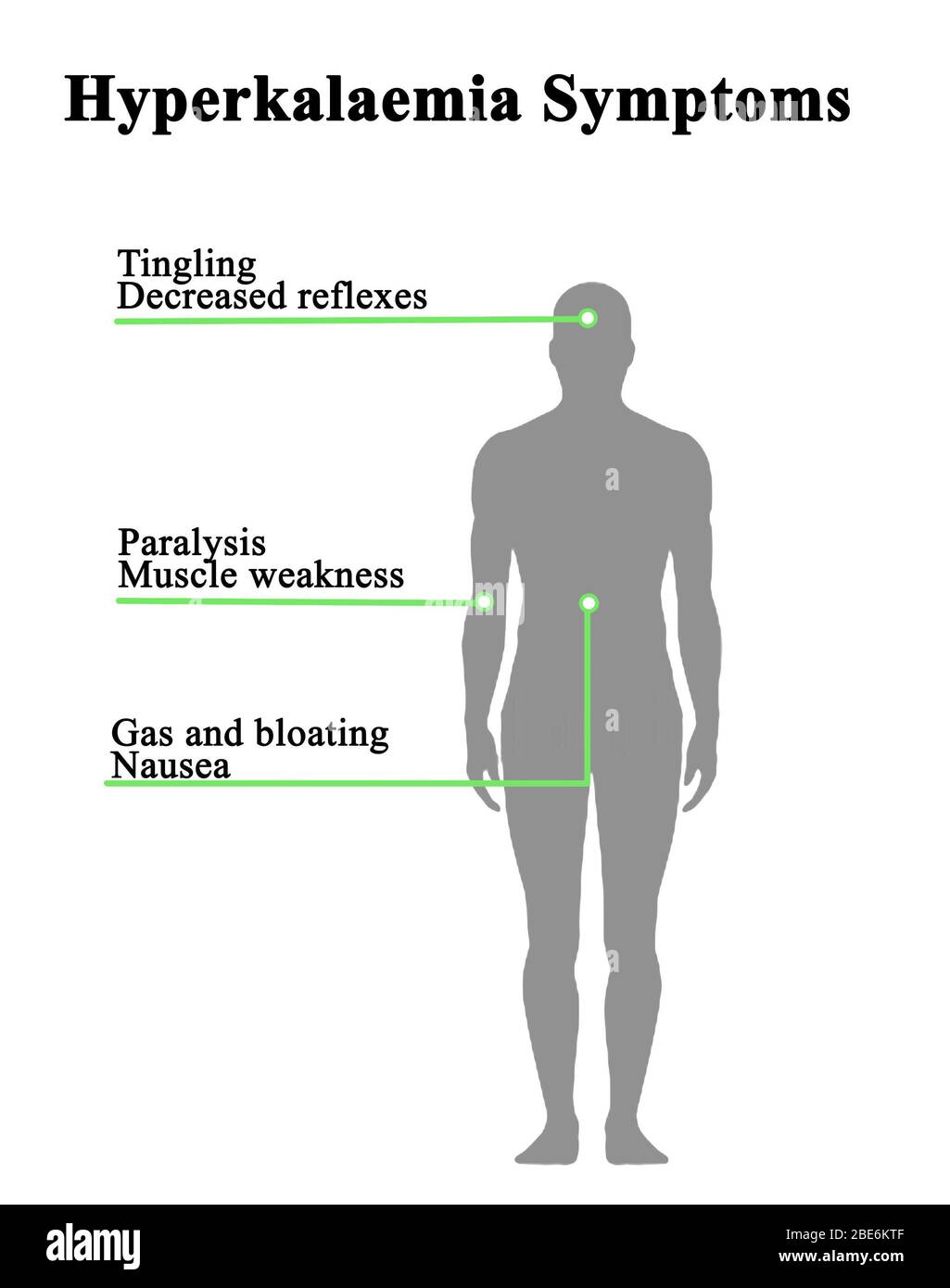 Six Symptoms of Hyperkalaemia Stock Photo - Alamy