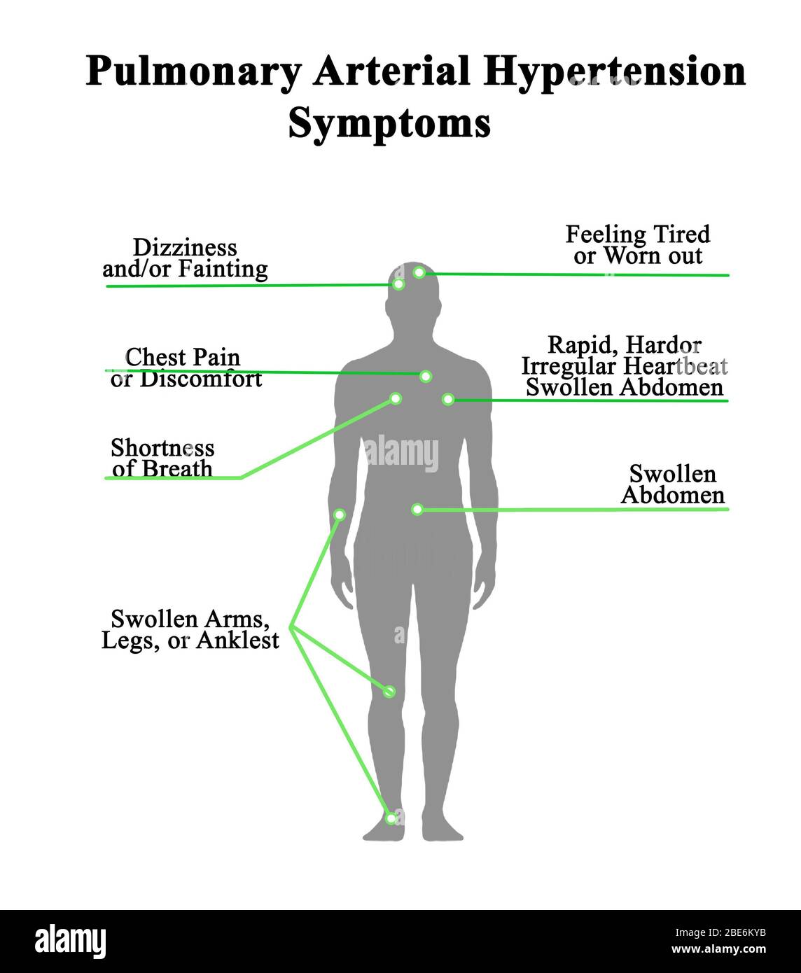 Seven Pulmonary Arterial Hypertension Symptoms Stock Photo - Alamy