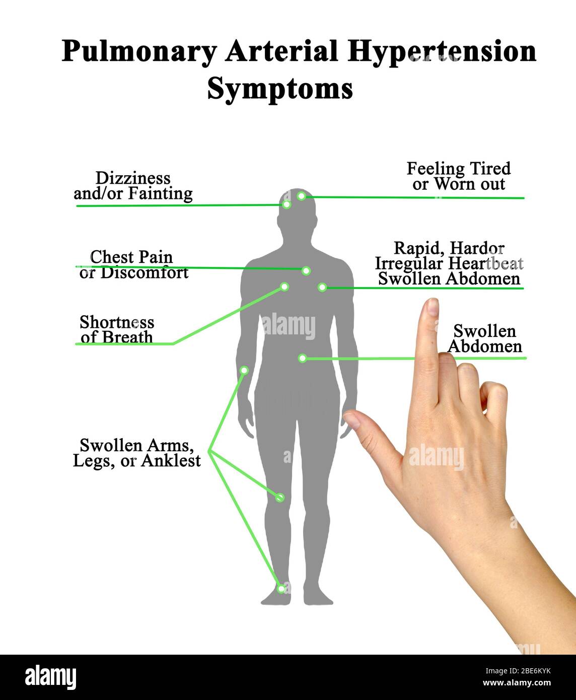 Seven Pulmonary Arterial Hypertension Symptoms Stock Photo - Alamy