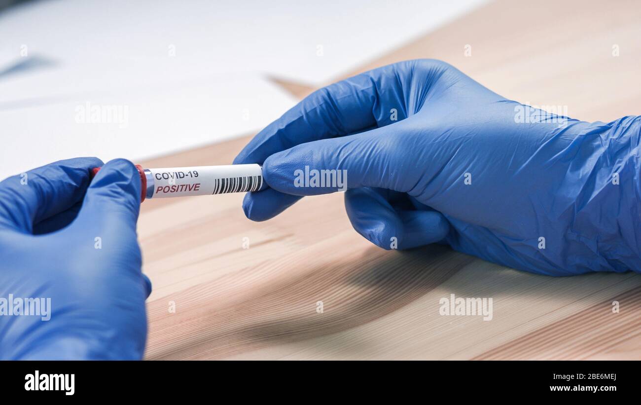 Coronavirus Infected Swab Test Sample in Doctor Hands. COVID-19 ...