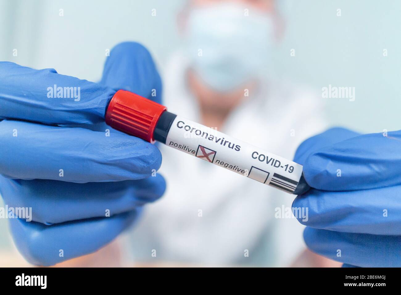 Coronavirus Infected Swab Test Sample in Doctor Hands. COVID-19 ...