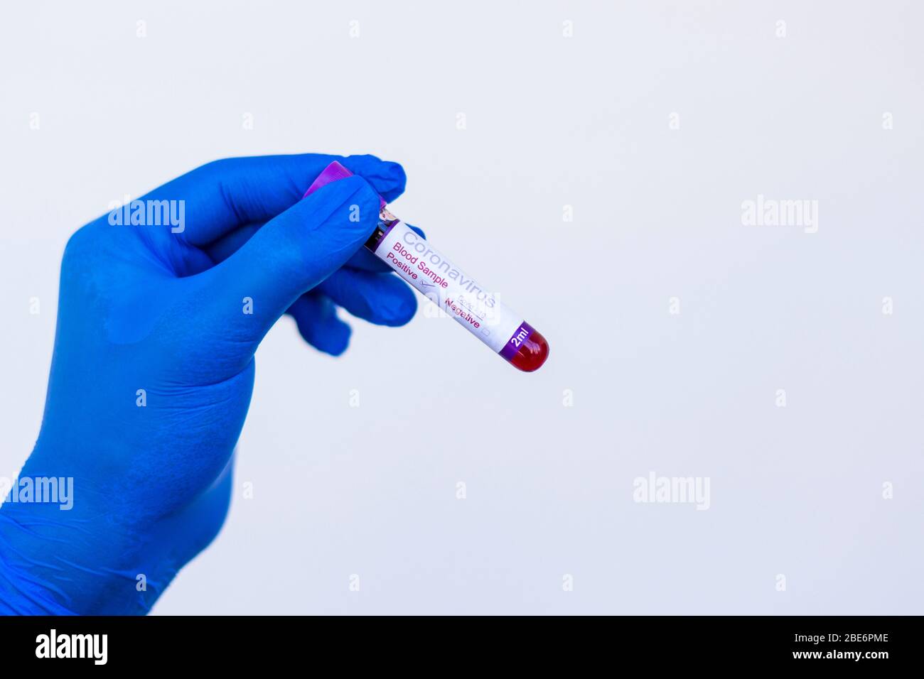 A gloved junior doctor holding a positive blood test result for ...